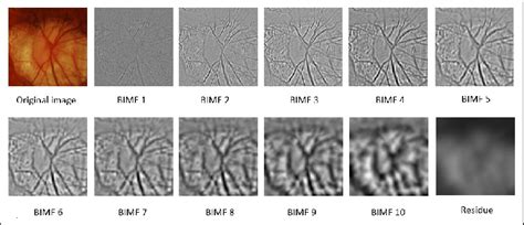 Example 3 Glaucoma Retina Image Image Decomposed Bemd Components In