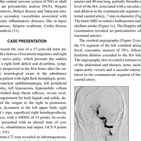 Cerebral Angiography Left Va V4 Segment A Concentrically Focal Download Scientific Diagram