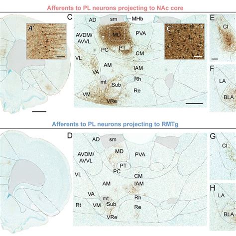 Retrograde Tracing Of Prelimbic Pl Neurons Projecting To Nucleus Download Scientific Diagram