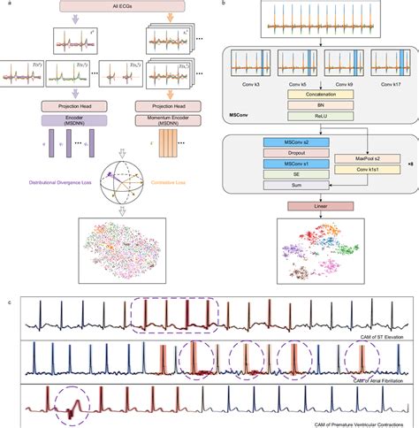 Neural Network Architectures And Visualization Of Models Attention A Download Scientific