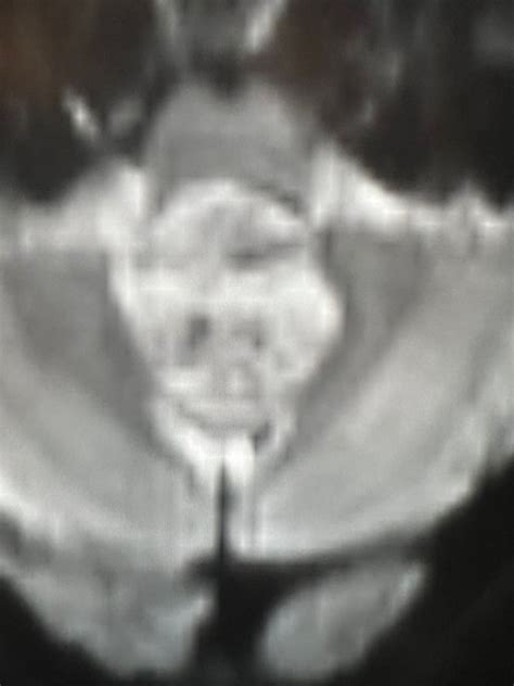 Spin Academics On Linkedin Tip Of The Day 💡 Diffusion Restriction Is