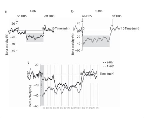 Time Course Of Beta Activity Beta Power Modulation During Experimental