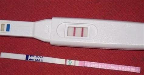 孕媽辛苦懷上雙胞胎，醫生告知連體，堅持剖腹產下後痛哭不已 每日頭條