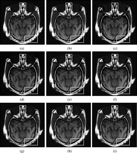 Image Fusion With Nonsubsampled Contourlet Transform And Sparse Representation