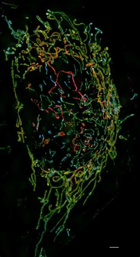 Structured Illumination Microscopy Techniques Nikon Small World
