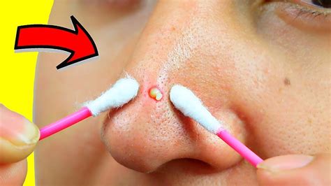 10 Weird Beauty Hacks You Need To Try Youtube