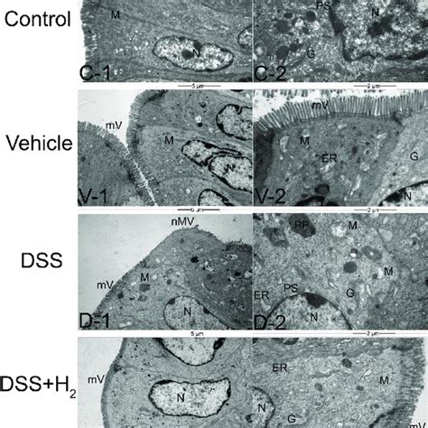 Representative Transmission Electron Microscopy Tem Micrographs Download Scientific Diagram