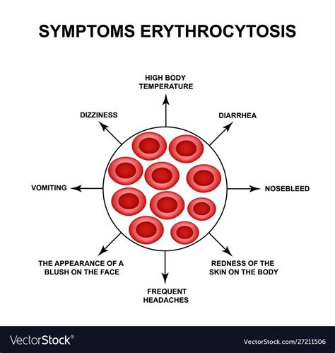 Erythrocytosis Symptoms An Increase Royalty Free Vector