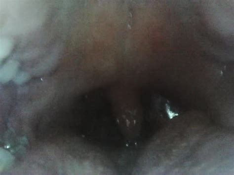 Inside The Giant Wet Mouth