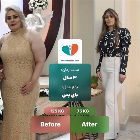 گالری وبسایت رسمی دکتر سعید صفری