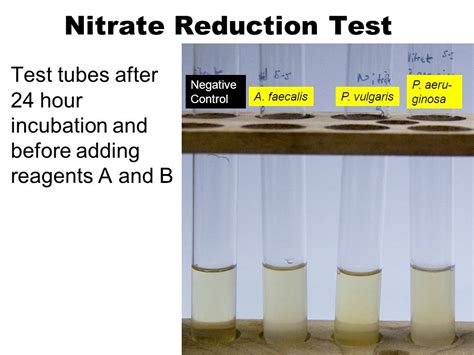 Nitrate Reduction Test E Coli