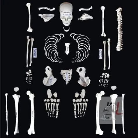Disarticulated Skeleton Human Imp Disarticulated Bone Set At ₹ 9999