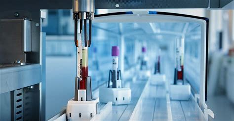 Global Laboratory Automation Market Size Share Growth Report 2030