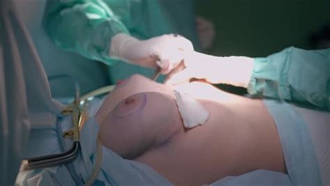 Side View Naked Breast Of Patient On Surgical Table With Hands Of Surgeon And Nurse Performing