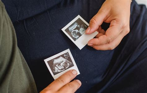 6 Common Mistakes To Avoid When Using The Ovidrel Trigger Shot Femtech Insider