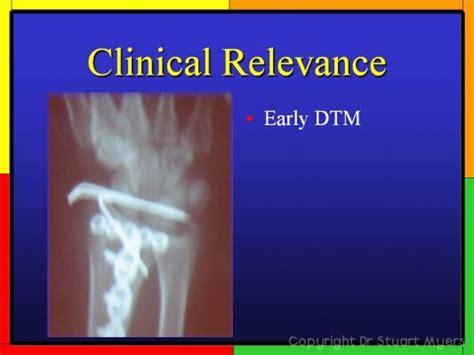 Dart Throwing Motion