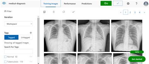 Github Enigmacoder Bottuberculosis Diagnosis