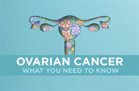Ovarian Cancer What You Need To Know Comanche County Memorial