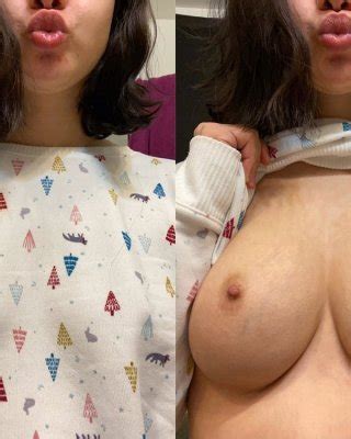 Brace Face Porn Pictures XXX Photos Sex Images PICTOA