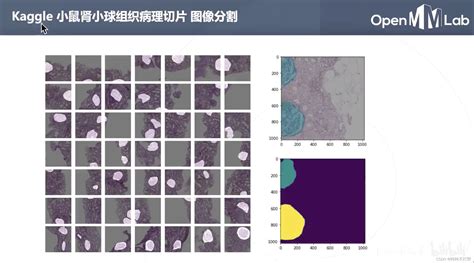 Openmmlab Ai实战营第二期——5 1语义分割与mmsegmentationopenmmlab 第二期 Csdn博客