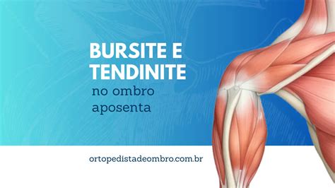 Bursite E Tendinite No Ombro Aposenta
