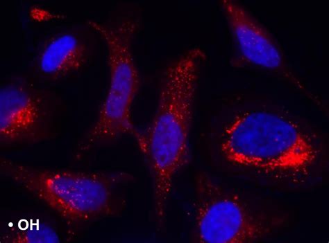 A Novel Fluorescent Probe For Imaging And Detecting Hydroxyl Radical In