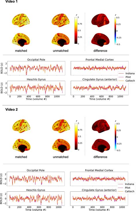 Exploratory Comparison Of Brain Response Consistency For Matched Download Scientific Diagram