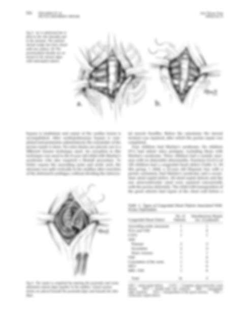 Solution A 26 Year Review Of Pectus Deformity Repairs Including