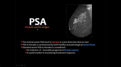 8 Prostate Imaging II TEC Prof Mamdouh Mahfouz YouTube