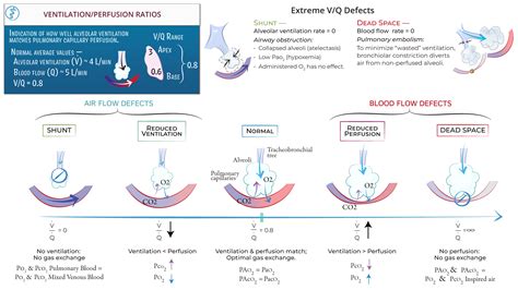 Respiratory System Ventilation To Perfusion Ratios And Defects Ditki