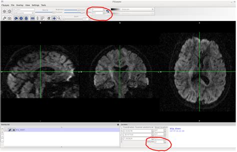 Diffusion Mri Basics Visualization And Preprocessing Mri On Bear