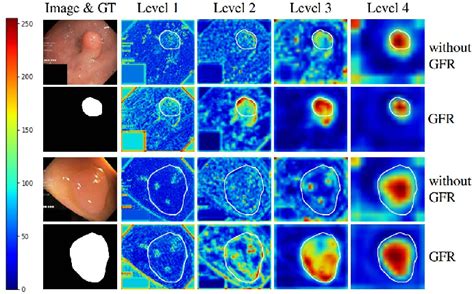 Figure 1 From Global And Local Feature Reconstruction For Medical Image Segmentation Semantic