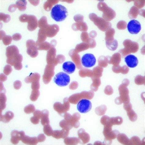 Photomicrograph Of The Light Microscopy Of The Gallbladder Light