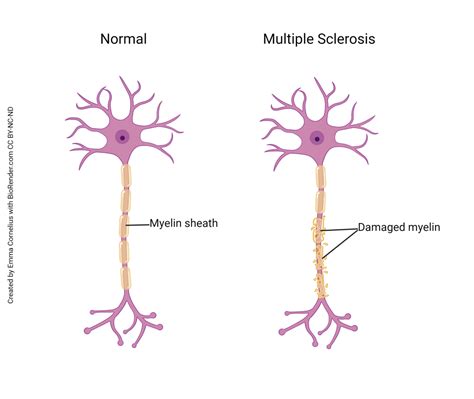 The Myelin Sheath Developing Expertise In Neuroscience