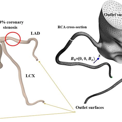 Computational Domain With Three Investigated Cross Sections Of The Rca Download Scientific