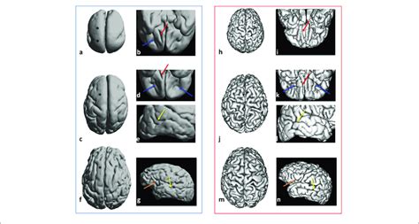 Three Dimensional Views Of Cortical Surface Reconstruction Of Three