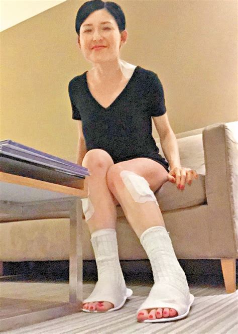 情傷加腳傷 承認有拗撬 52歲劉美君8年情玩完 東方日報