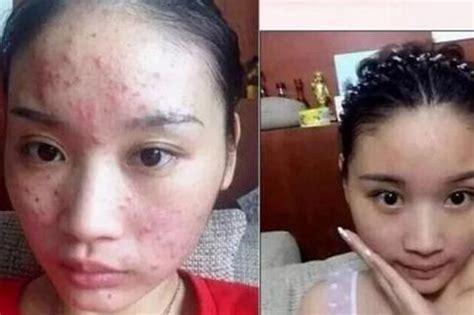 洗脸后干燥紧绷毛孔粗犯这3禁忌