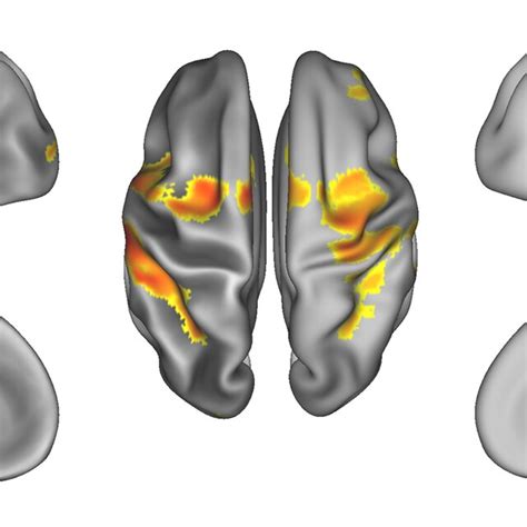 Representational Similarity Analysis A Category‐selective