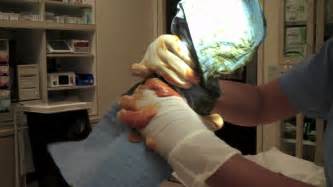 Surgery Prep Youtube