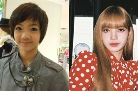 Lisa Before And After Celebrities Income
