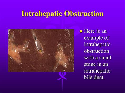 Digestive System Part 3 Odds And Ends Ppt Download