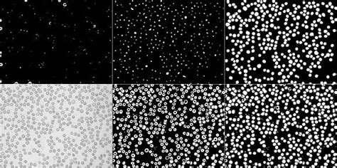 erythrocyte image analysis algorithm x25 a filtered green
