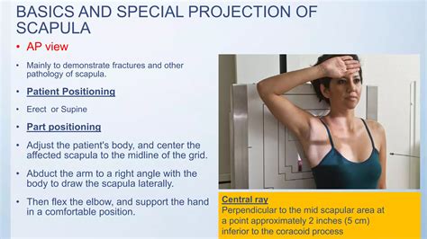 X Ray Views Of Shoulder Joint And Related Structures Pptx