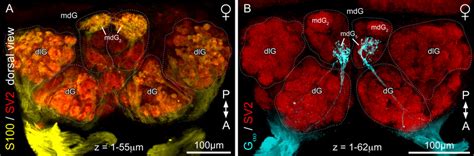 Schematic Maps Summarizing The Distribution Of Glomeruli Glomeruli Are Download Scientific