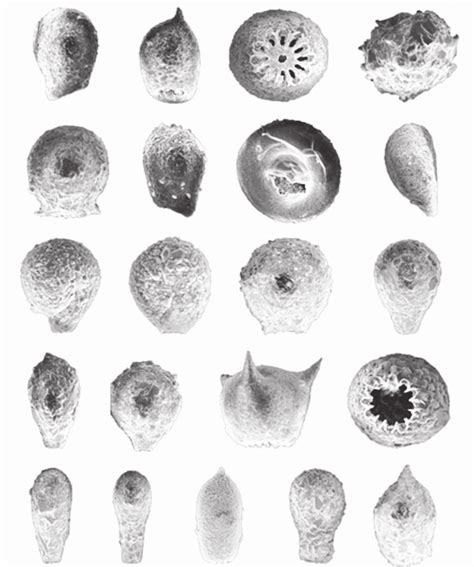 Principais Espécies Encontradas Nas Lagoas 1 Difflugia Oblonga Var Download Scientific