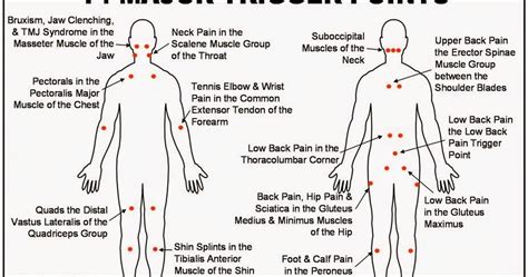 Family First Chiropractic And Wellness What Is Trigger Point Therapy