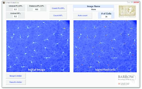 Image Of The Program Interface The Umbral Inner Plexiform Layer Outer Download Scientific