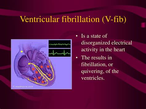 Ppt Aed Automated External Defibrillation Powerpoint Presentation Free Download Id 5507624