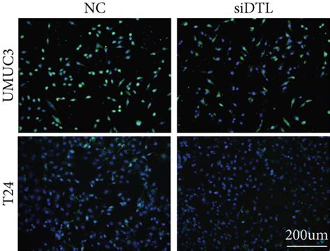 Depletion Of Dtl Suppresses Bca Cell Proliferation And Restrains G2
